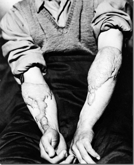 OLTRE IL MURO: ARTE e FOTOGRAFIA: THE DROPPING OF THE ATOMIC BOMB, 66 ...